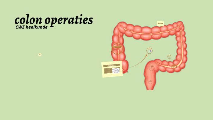 colon operaties by Selina Onvlee on Prezi