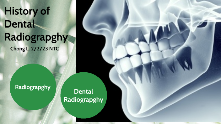 Dental Radiography History by Chong lor on Prezi