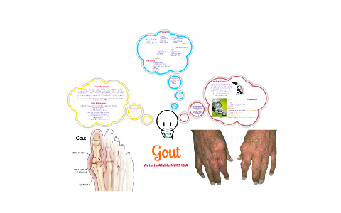 Gout Concept Map by Victoria Afable on Prezi