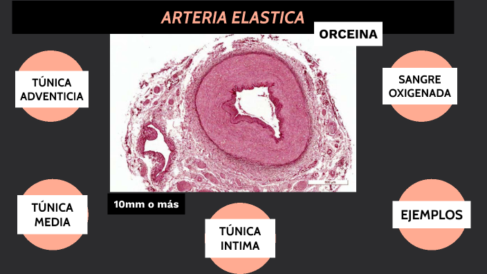 ARTERIA ELASTICA by Constanza Vallejos on Prezi