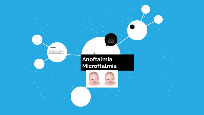 Anoftalmia Microftalmia by Kevin Gabo Aranda Vázquez on Prezi