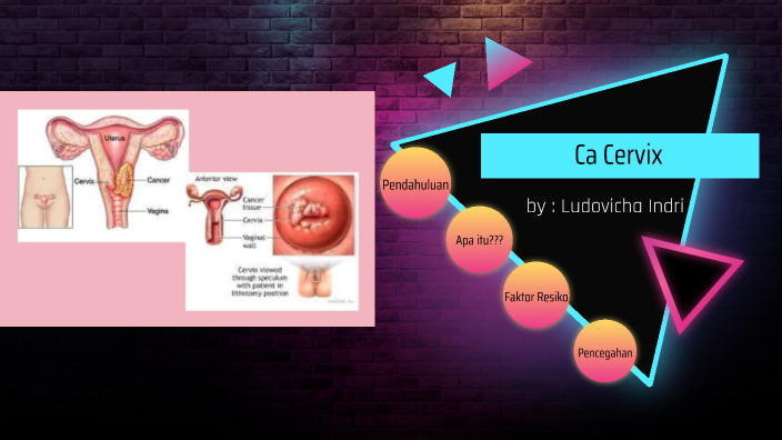 ca cervix by Ludovicha Indri on Prezi