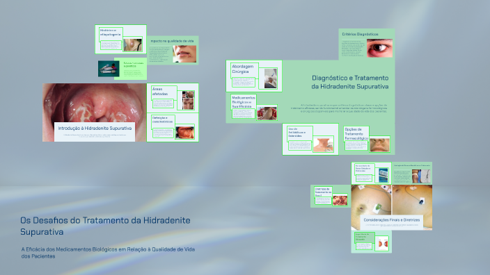 Os Desafios do Tratamento da Hidradenite Supurativa by SUELLEN FONSECA ...