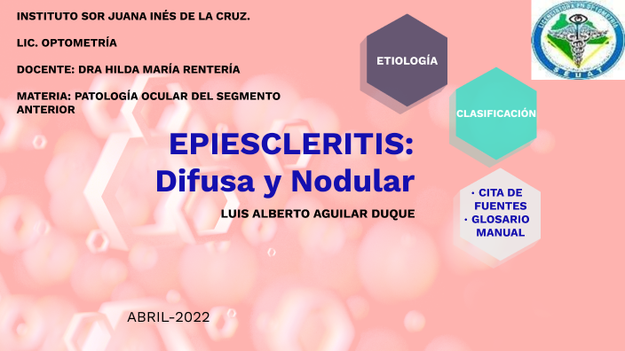 EPIESCLERITIS DISUSA Y NODULAR by LUIS ALBERTO AGUILARERA on Prezi