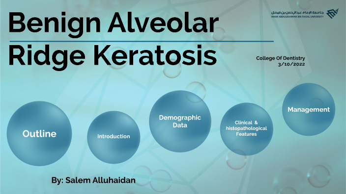 Benign Alveolar Ridge Keratosis by Salem on Prezi