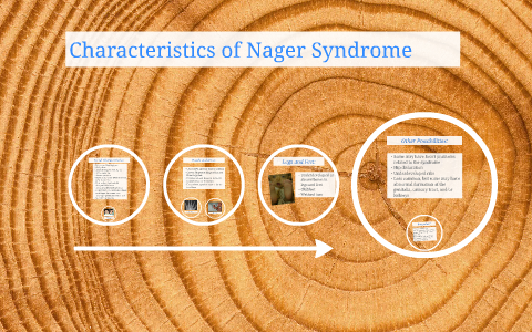 Characteristics of Nager Syndrome by Tiffany Bales on Prezi