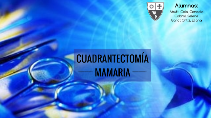 Cuadrantectomía mamaria by Eli Garat Ortiz on Prezi