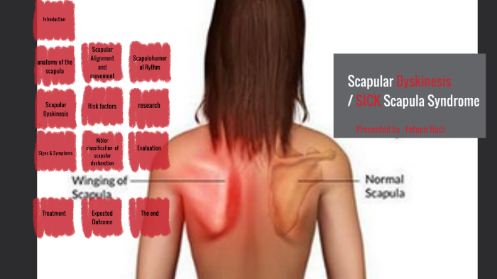 Scapular dyskinesis by Fotoon Hadi on Prezi