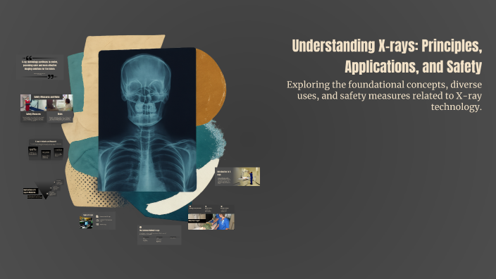 Understanding X-rays: Principles, Applications, and Safety by محمد ...