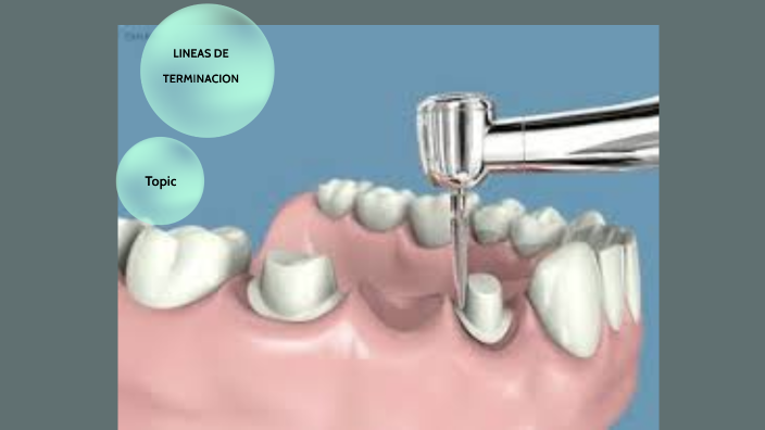 LINEAS DE TERMINACION by IVAN CRUZ on Prezi