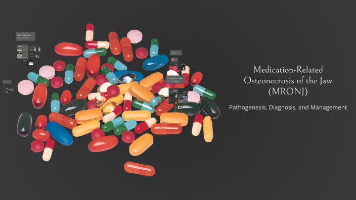 Medication-Related Osteonecrosis of the Jaw (MRONJ) by Ayman Selem on Prezi