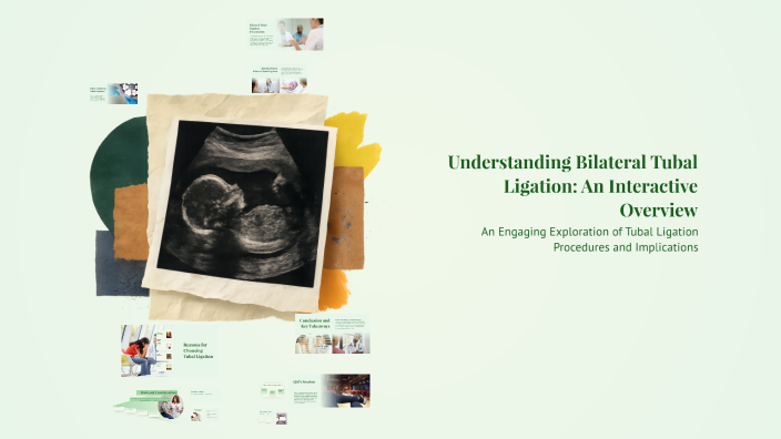 Understanding Bilateral Tubal Ligation: An Interactive Overview by ...