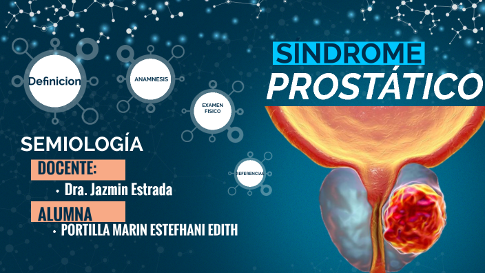 SINDROME PROSTATICO by Estefhani portilla on Prezi