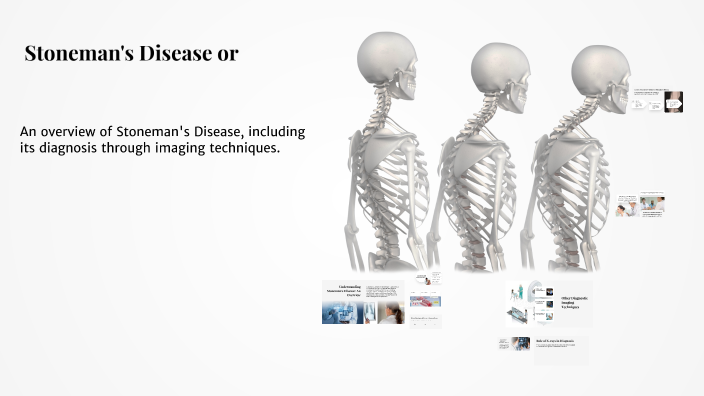 Understanding Stoneman's Disease (Munchmeyer's Syndrome) by Melanie ...