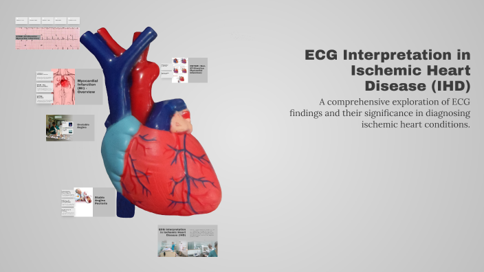 ECG Interpretation in Ischemic Heart Disease (IHD) by zoome ee on Prezi