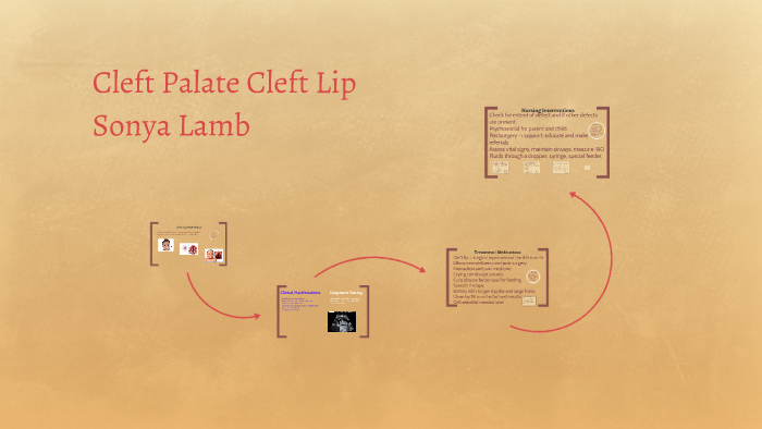 Cleft Palate by Sonya Lamb on Prezi
