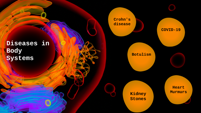 Diseases of the body systems by Naomi Hungler on Prezi