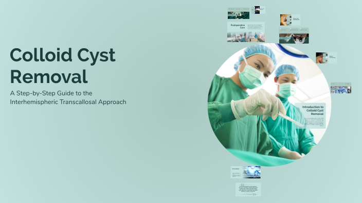 Colloid Cyst Removal by Hayder Albaqer on Prezi