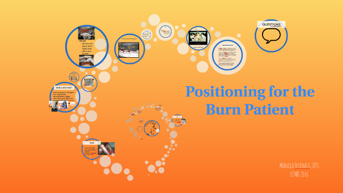 Positioning for the Burn Patient by Monica Feldhaus on Prezi