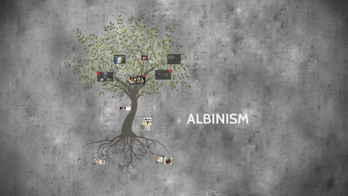 Albinism by mariam lafi on Prezi