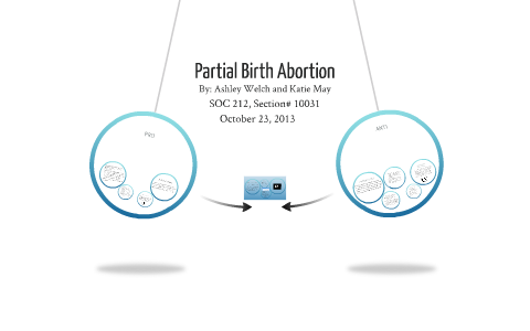 Partial Birth Abortion by Kaitlin May on Prezi