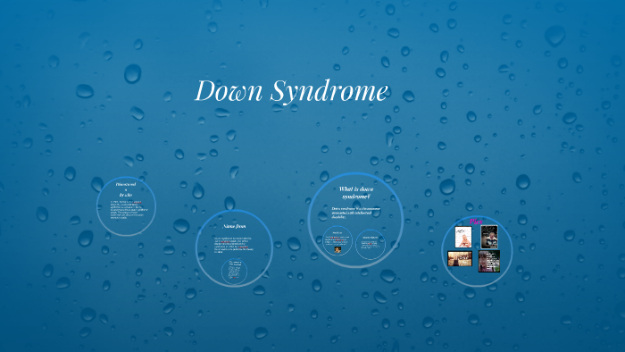 In 1866, Doctor John Langdon Down first described Down syndr by zaret ...