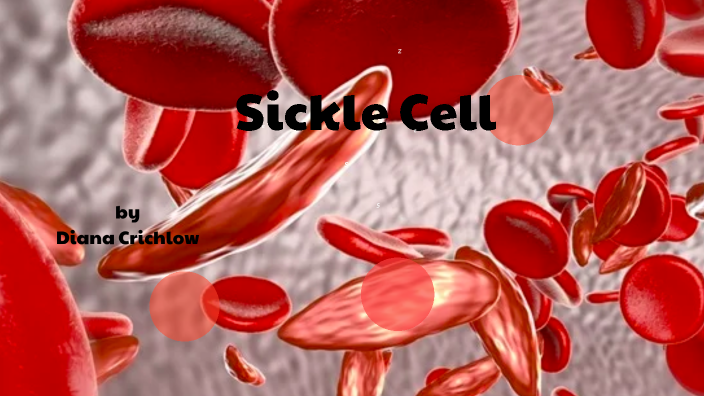 SICKLE CELL - FIRST AID TRAINING by Diana Crichlow on Prezi
