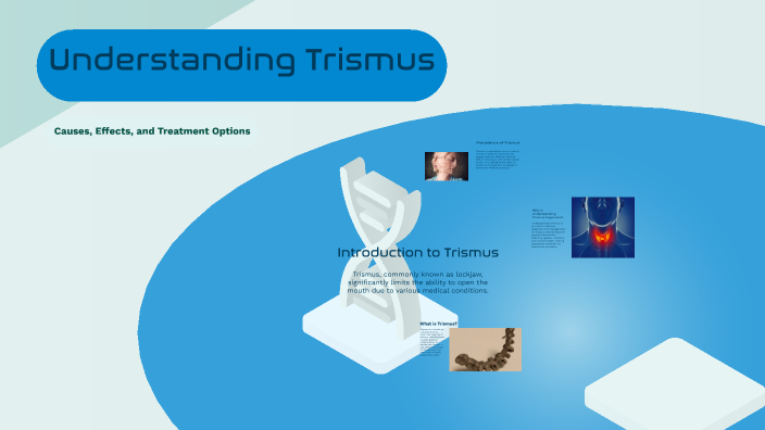 Understanding Trismus by mohamed zain on Prezi