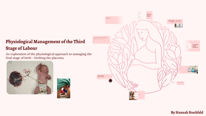 Physiological Management of the Third Stage of Labour by on Prezi