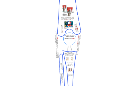 ACL Repair: Patellar vs. Hamstring transplant by Dave Brantner on Prezi