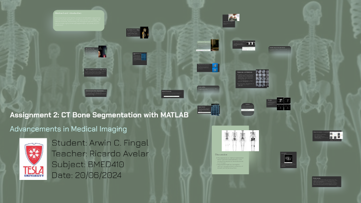 Bone Segmentation In Ct Images Using Matlab By Ac Fingal On Prezi