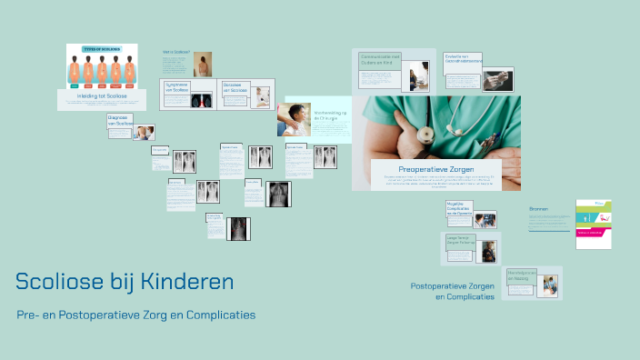 Scoliose bij Kinderen by Benjamin Willems on Prezi