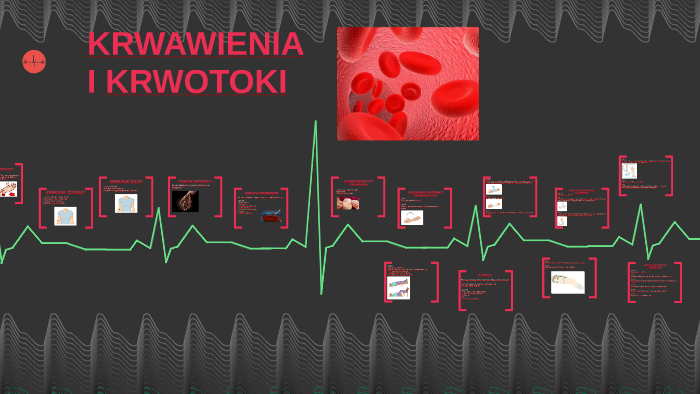 KRWAWIENIA I KRWOTOKI by Gabriela Kowalska on Prezi