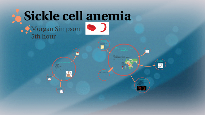 Sickle cell anemia by morgan simpson on Prezi