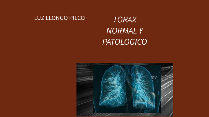 TAC DE TORAX NORMAL Y PATOLOGICO by luz edelmira llongo pilco on Prezi