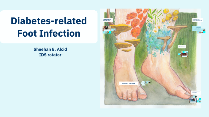 DM Foot: Understanding Diabetic Foot Conditions by Sheehan Jalanie ...
