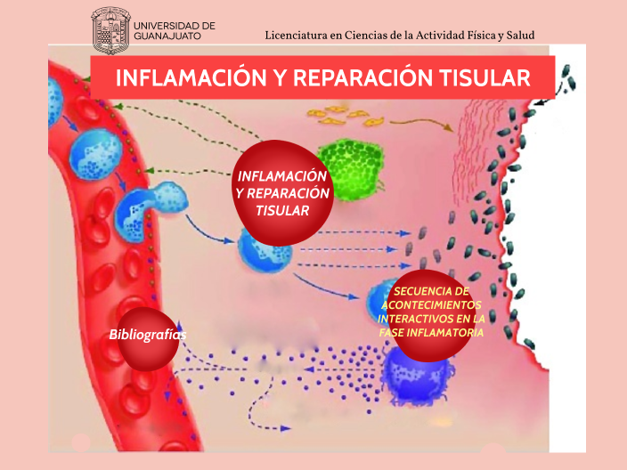 inflamación y reparación tisular by Juan Ignacio Valadez Godinez on Prezi inflamación y reparación tisular by Juan Ignacio Valadez Godinez on Prezi