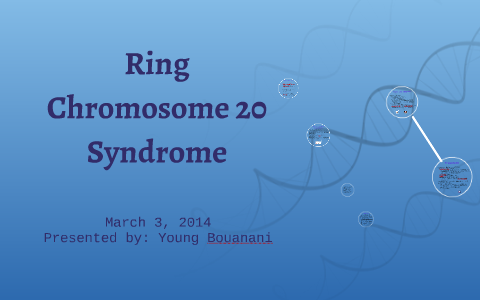 Ring Chromosome 20 Syndrome by Young Bouanani on Prezi