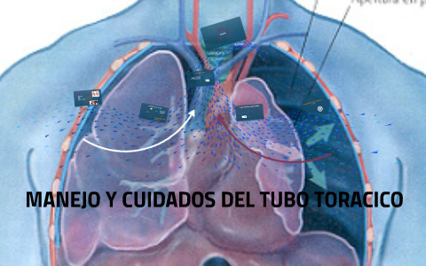 MANEJO Y CUIDADOS DEL TUBO TORACICO by Vanessa Yepez on Prezi