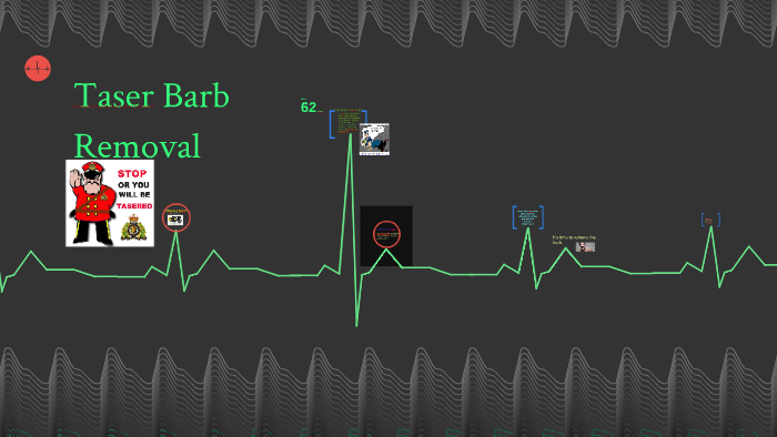 Taser Barb Removal by Olivia McConnell on Prezi