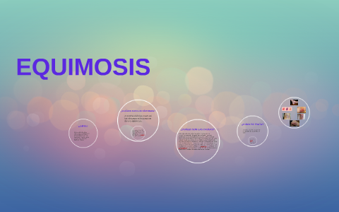 Equimosis