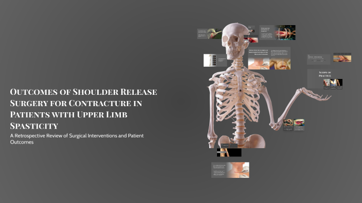 Outcomes of Shoulder Release Surgery for Contracture in Patients with ...