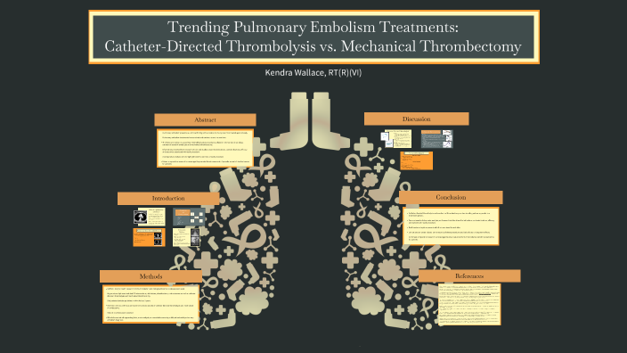 Trending Pulmonary Embolism Treatments: Catheter-Directed Thrombolysis ...