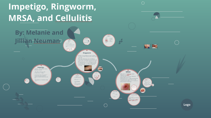 Impetigo, Ringworm, MRSA, and Cellulitis by Melanie Neuman on Prezi