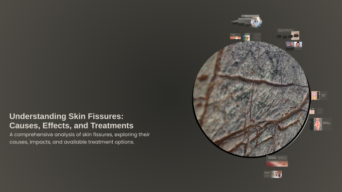 Understanding Skin Fissures: Causes, Effects, and Treatments by Chelsea ...
