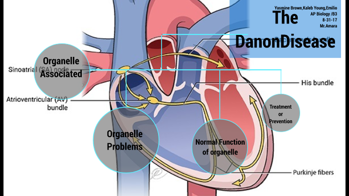 The Danon Disease by Yasmine Brown on Prezi
