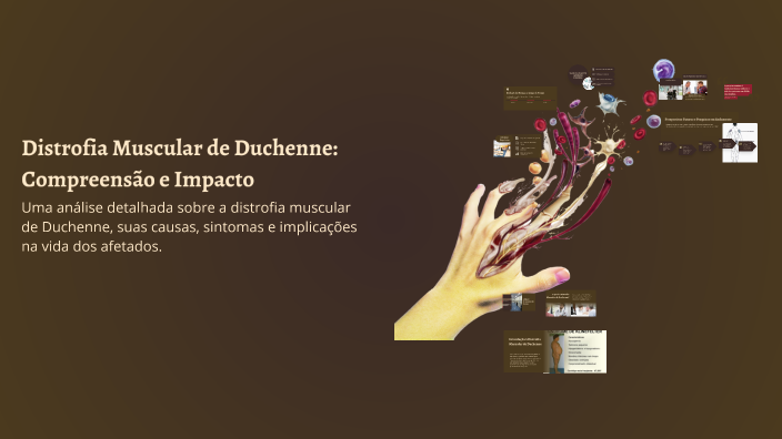 Distrofia Muscular de Duchenne: Compreensão e Impacto by Pterodactilo ...