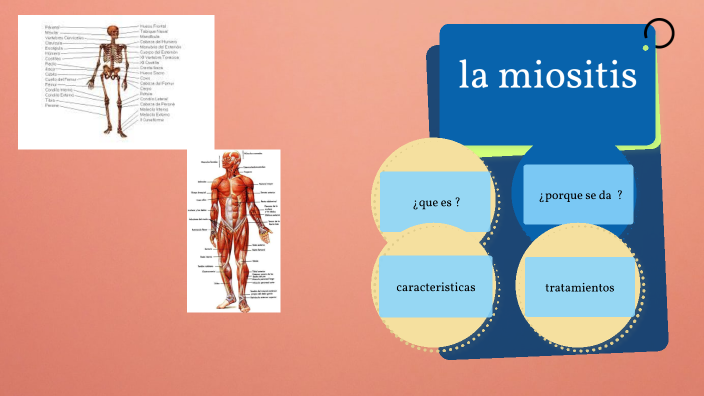 la miositis by isabel rojas rodriguez on Prezi