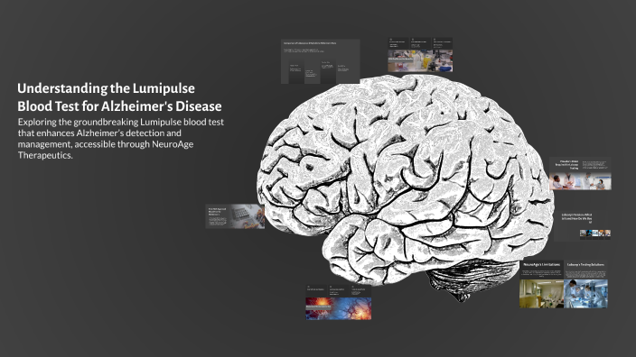 Understanding the Lumipulse Blood Test for Alzheimer's Disease by Aanya ...