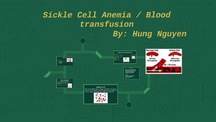 Sickle Cell Anemia / Blood transfusion by Hung Nguyen on Prezi